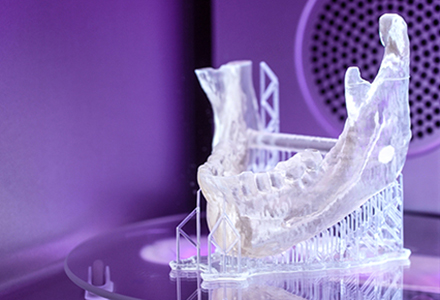 3D printing transforms how USF Health surgeons prepare for complex ...